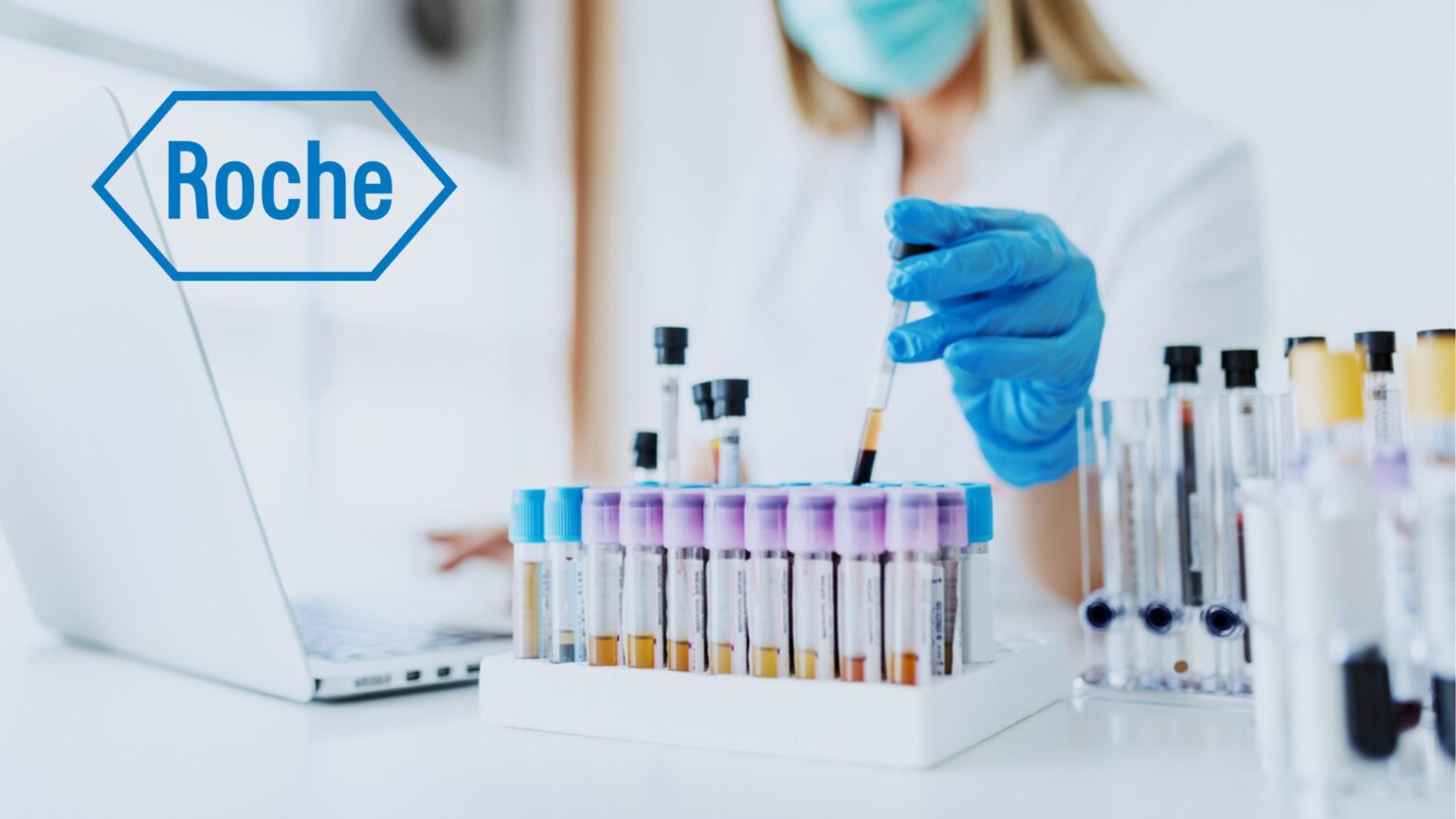 BinaryMed Partners with Roche to Minimise Pre-analytical Errors