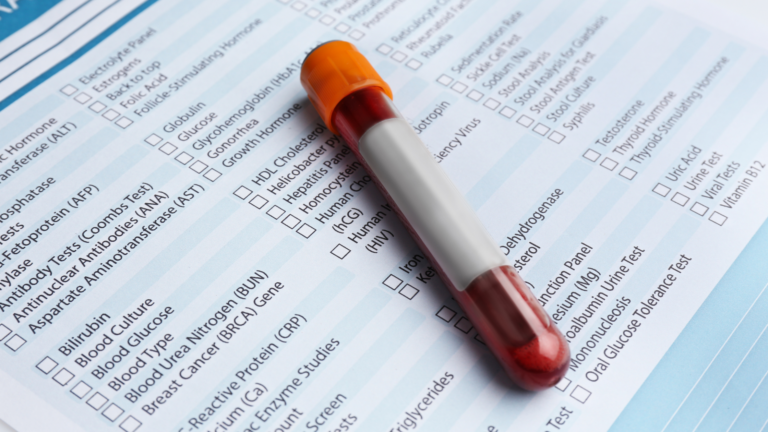 What is Pre-analytics and What Impact do Pre-analytical Errors Have on ...