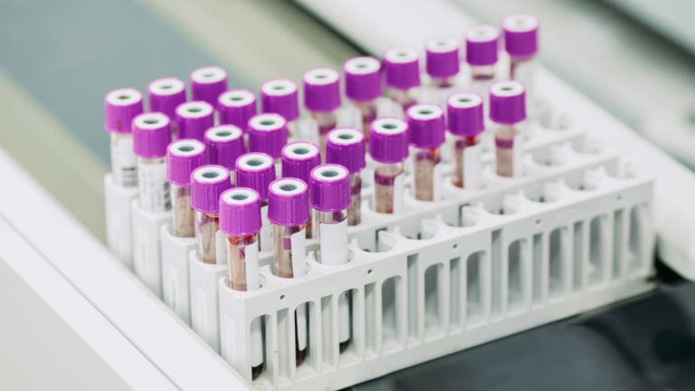 The Impact of Real-Time Specimen Tracking on the Pre-Analytical Phase